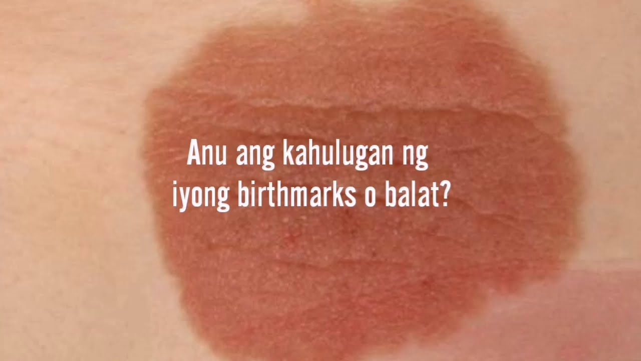 ANG KAHULUGAN NG INYONG BIRTHMARKS O BALAT - YouTube