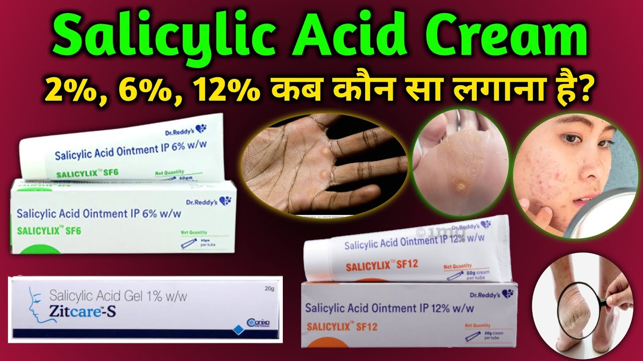 Salicylic acid ointment | Salicylic acid cream zitcare s gel salicylix ...