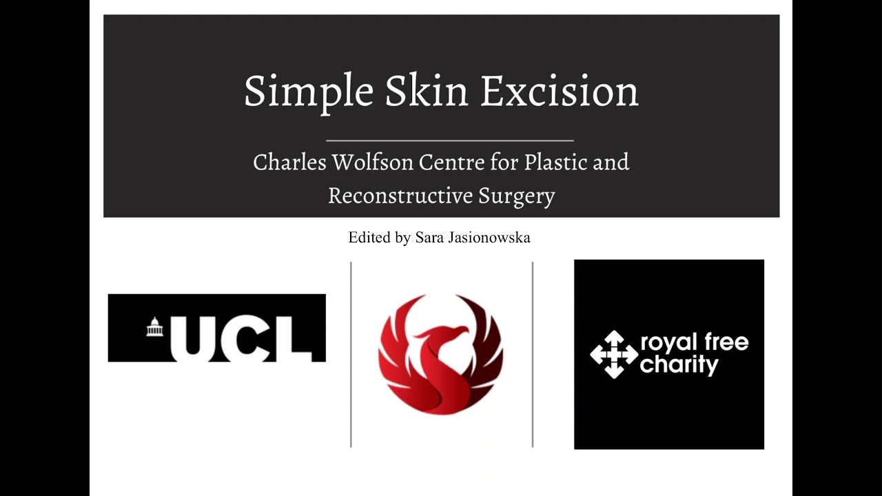 Simple skin excision - YouTube