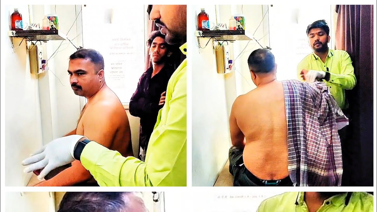 Fusion shoulder - YouTube