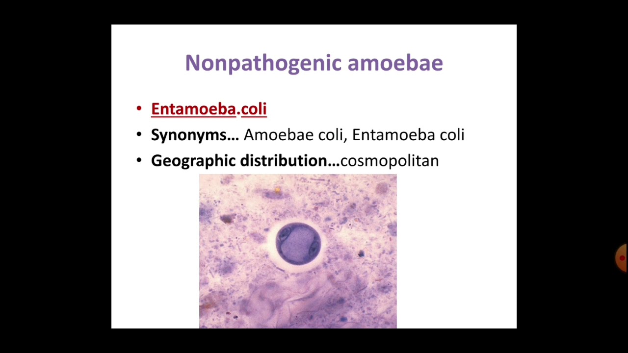 Non pathogenic amoebae part 4 - YouTube