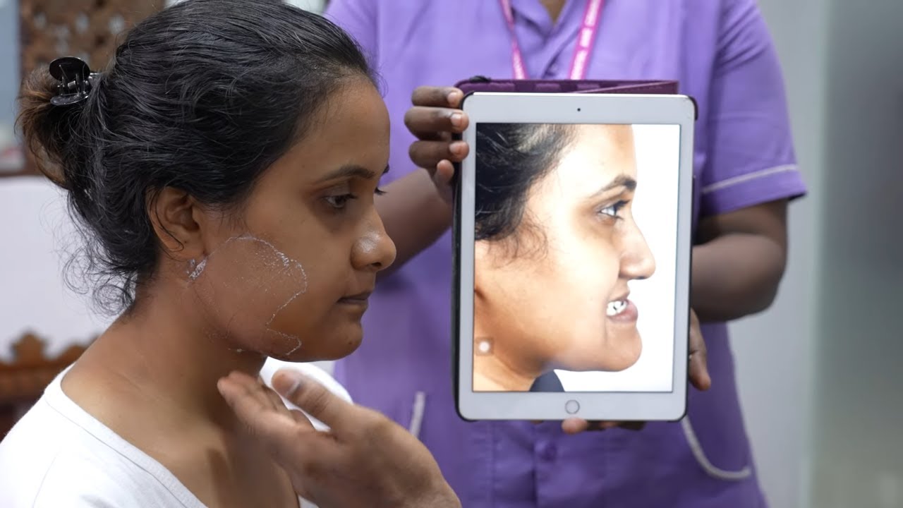 Surprising Results!!! Two Women in one Frame | Bimax Jaw Surgery - YouTube