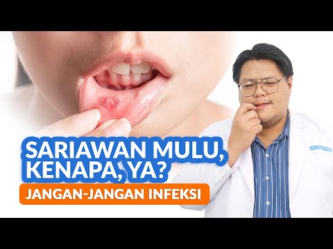 Apa sih, Penyebab Sariawan?