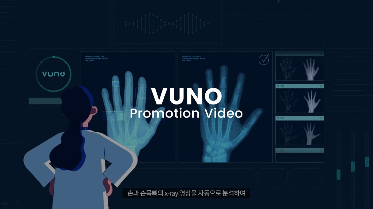 VUNO 제품홍보영상 (boneage™ forpa) - YouTube