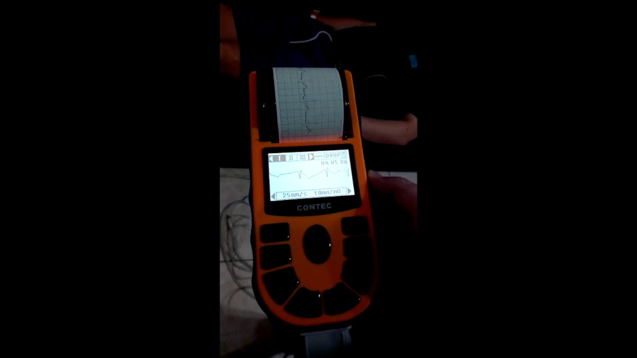 Electrocardiógrafo Portátil Contec Ecg80a (mercadolibre) - YouTube