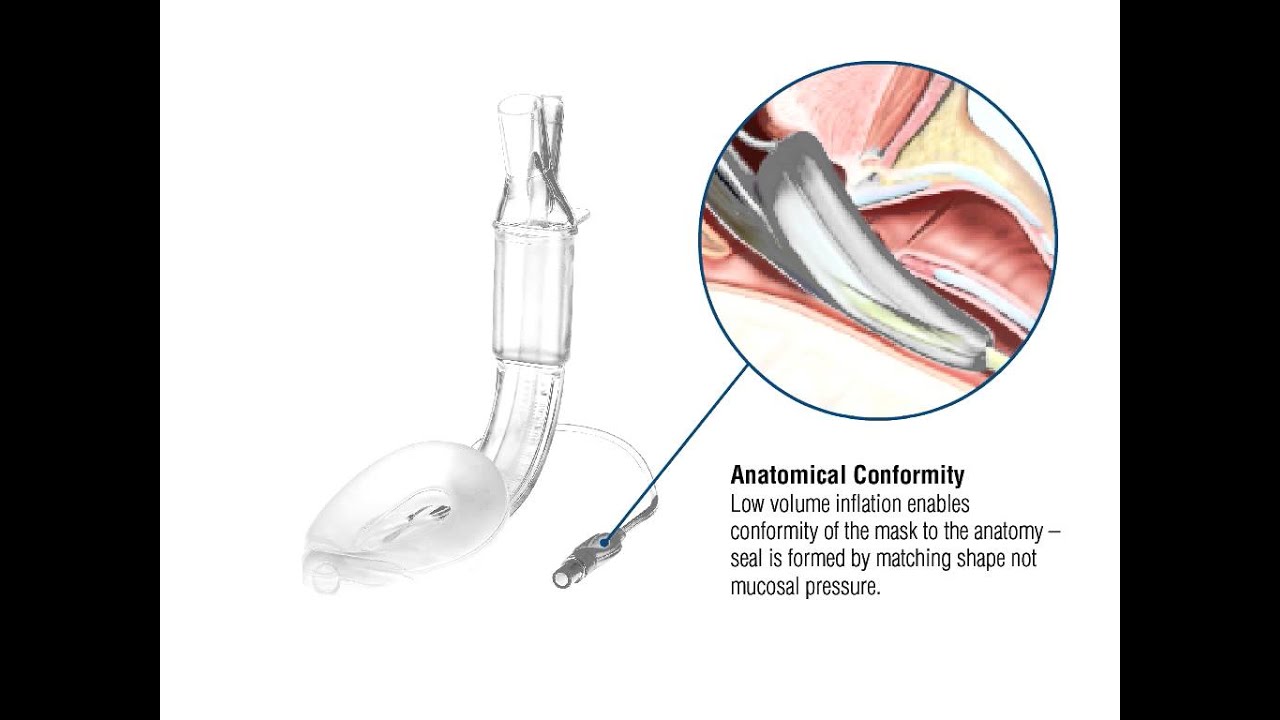 Features of the LMA Supreme™ - YouTube