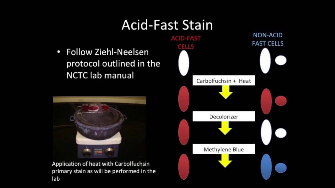 Acid Fast Stain - YouTube