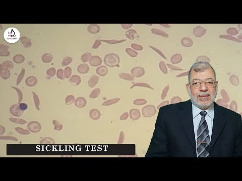Episode 5 : Sickling Test - YouTube