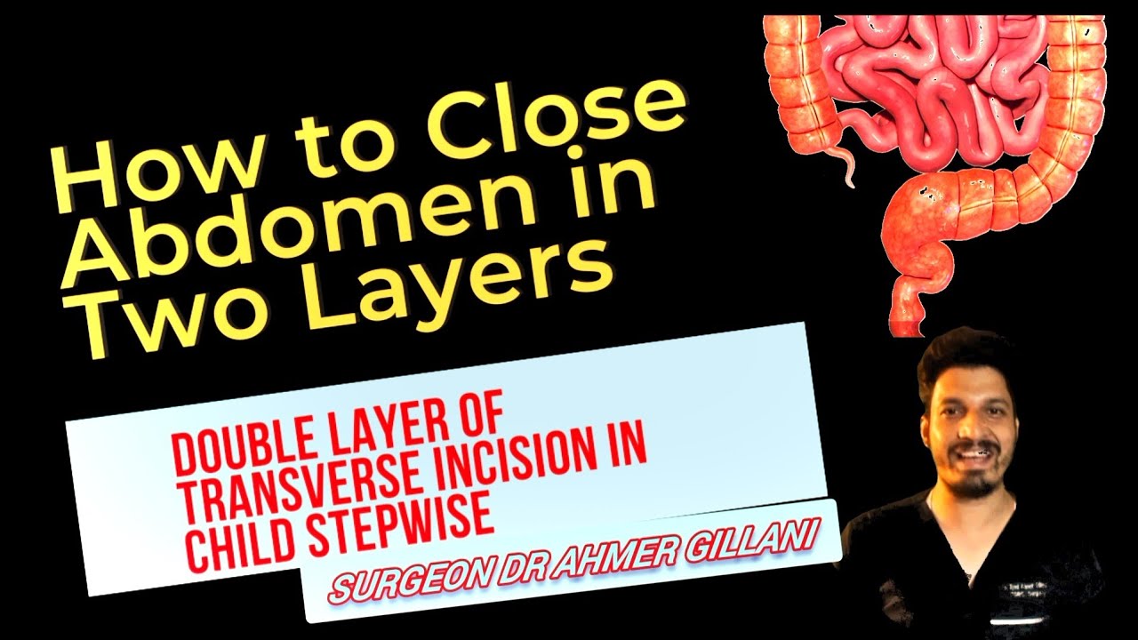 How To Close Abdomen ( Transverse Incision) in Two year Old Baby Wth ...
