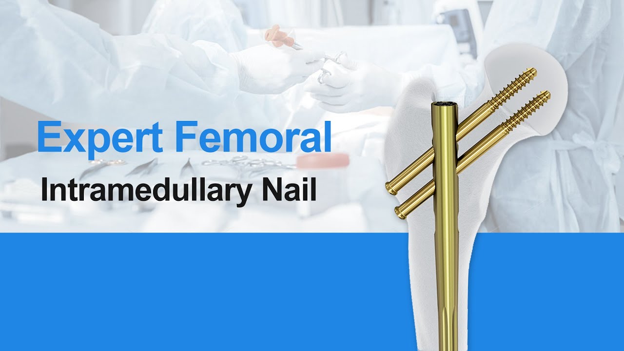 CZMEDITECH-Expert Femoral Intramedullary Nail Orthopedics implants ...
