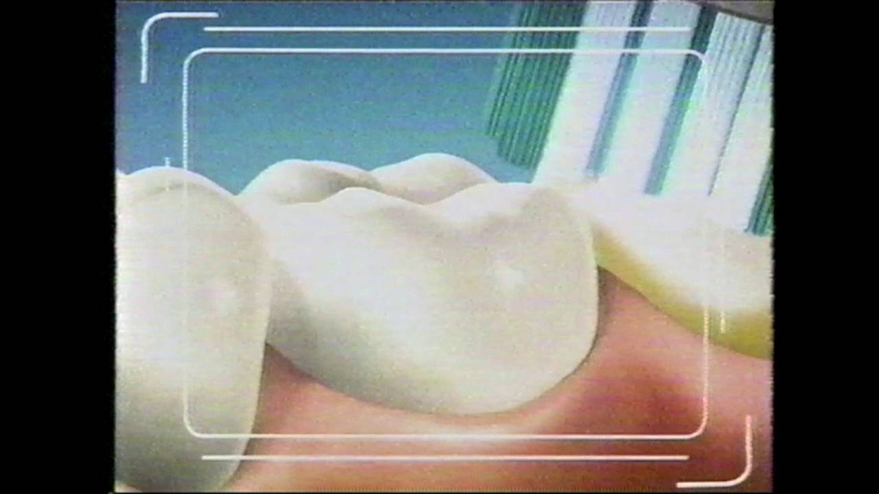 Braun Oral-B commercial (1999) - YouTube
