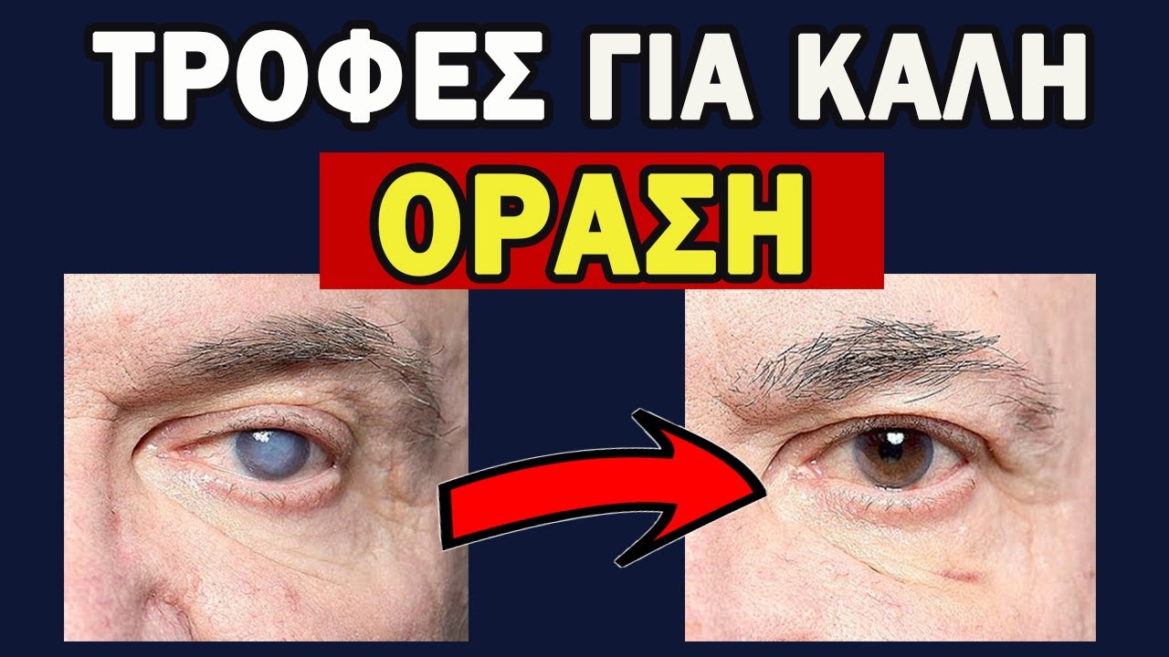 Λίστα Τροφών Που Βελτιώνουν Την Όραση 👉 Βάλτε ΑΜΕΣΑ Στην Διατροφή ...