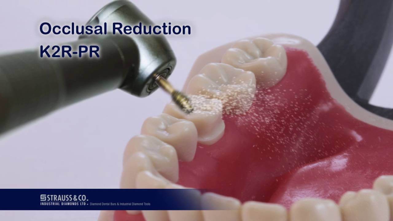 All Ceramic Crown Prepartion Kit - All Steps - YouTube