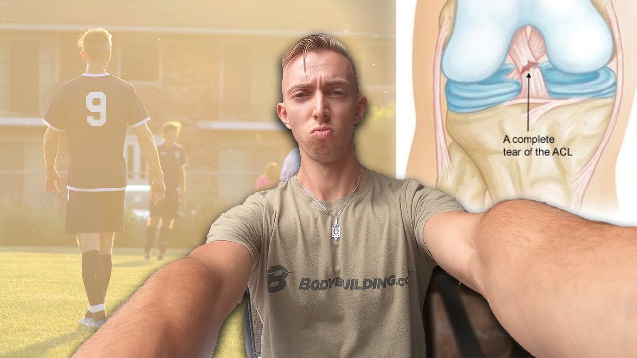 ACL + Meniscus Tear Update | Days Before Surgery and 6 Weeks After Tear ...