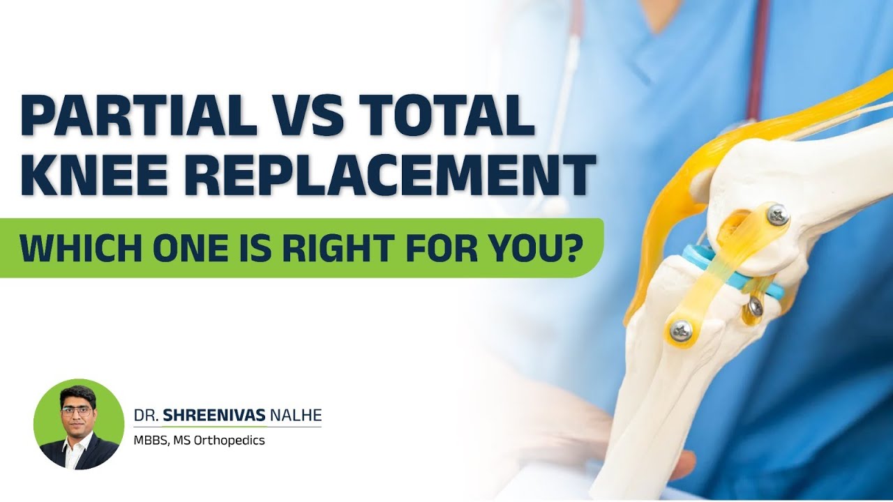 Partial vs Total Knee Replacement Surgery | Dr Shreenivas Nalhe - YouTube