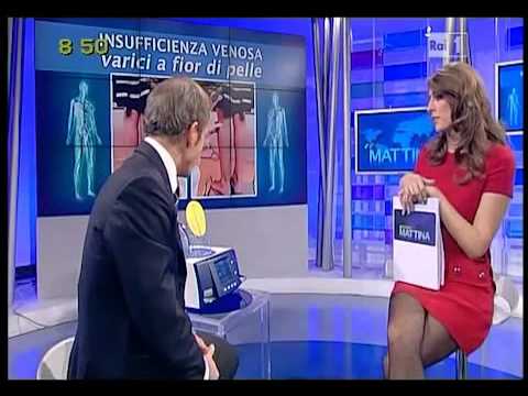 Prof. Massimo Danese RAI "Uno Mattina" - "Chirurgia endovascolare delle ...