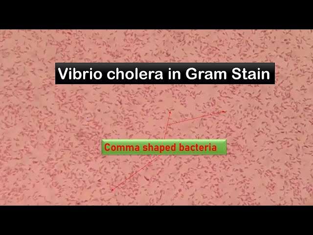 Vibrio Cholerae Gram Stain