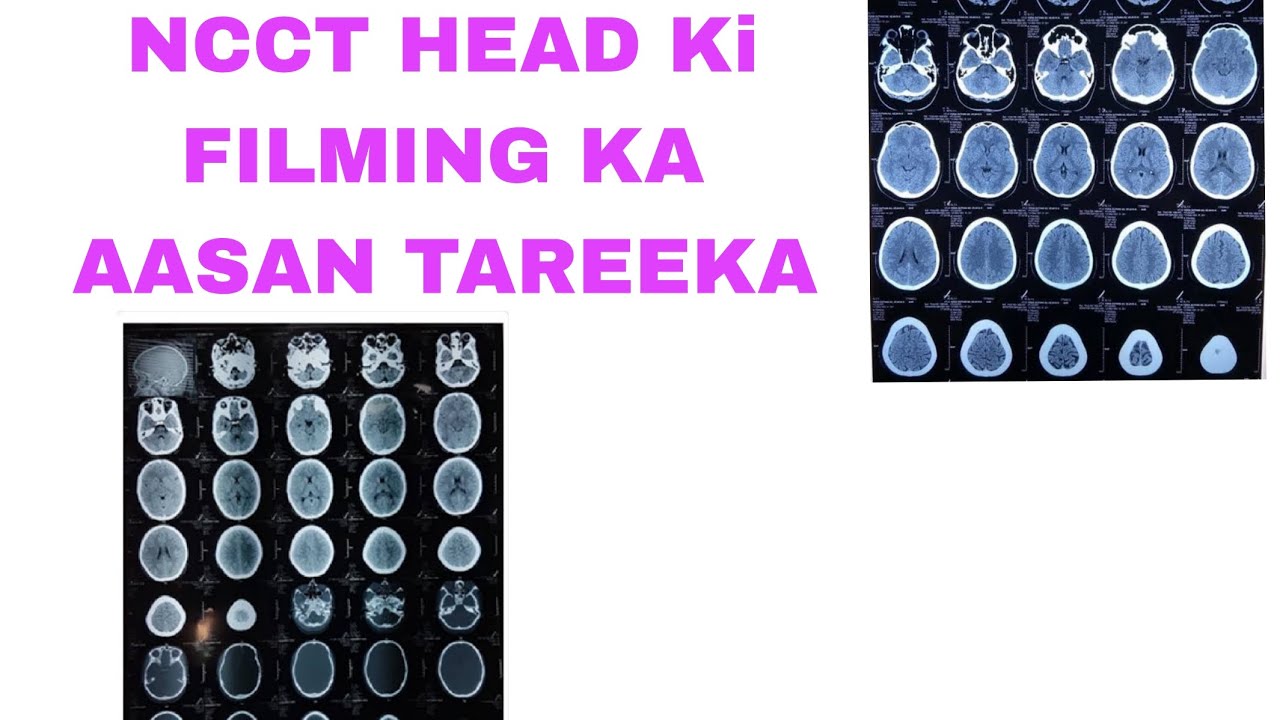 CT SCAN Brain plain filming process #ctscan #filming #unitedimaging # ...