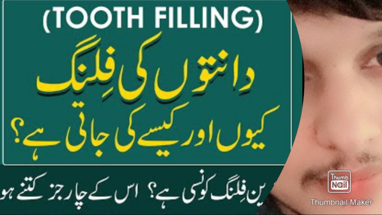 The Ultimate Guide to Teeth Fillings|Teeth Filling 101:What to Expect ...