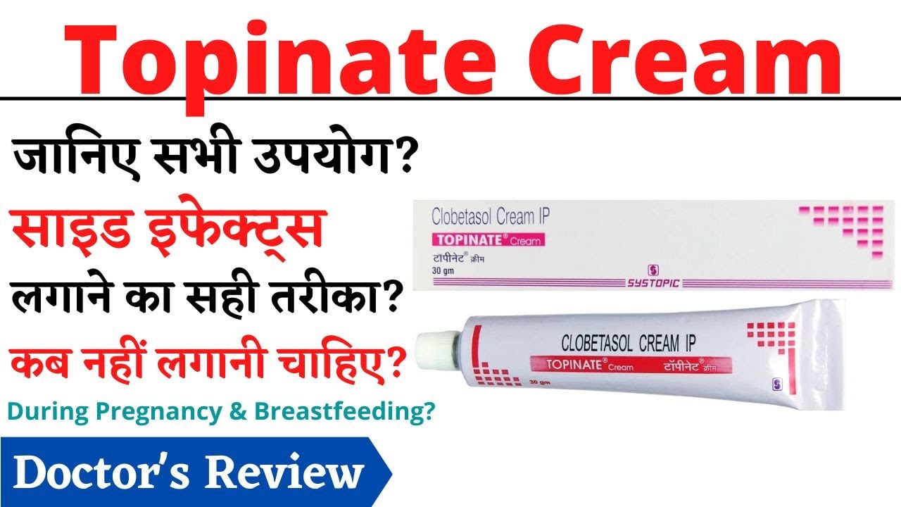 Topinate Cream Uses & Side Effects in Hindi | Topinate Cream - YouTube