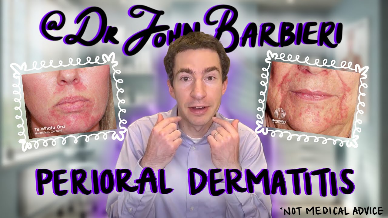 Dermatologist Explains Perioral Dermatitis How To Identify Causes