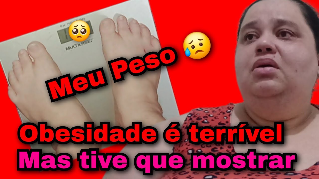 Meu Peso Atual: Obesidade acaba com seu físico e emocional/ Mas ...