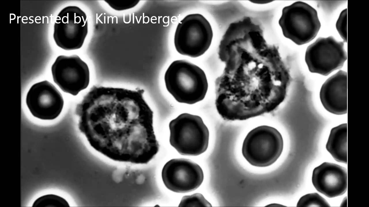 white blood cells and fungus in blood - YouTube