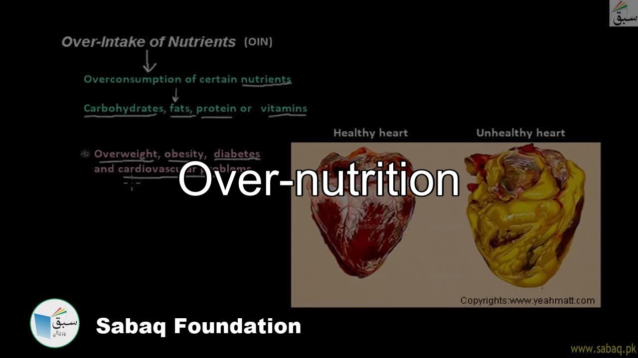 Over-nutrition, Biology Lecture | Sabaq.pk - YouTube