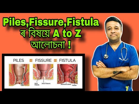 PILES, FISSURE, FISTULA-ৰ A to Z আলোচনা ৷ শৌচ কৰোতে তেজ ওলোৱা তথা বিষ ...