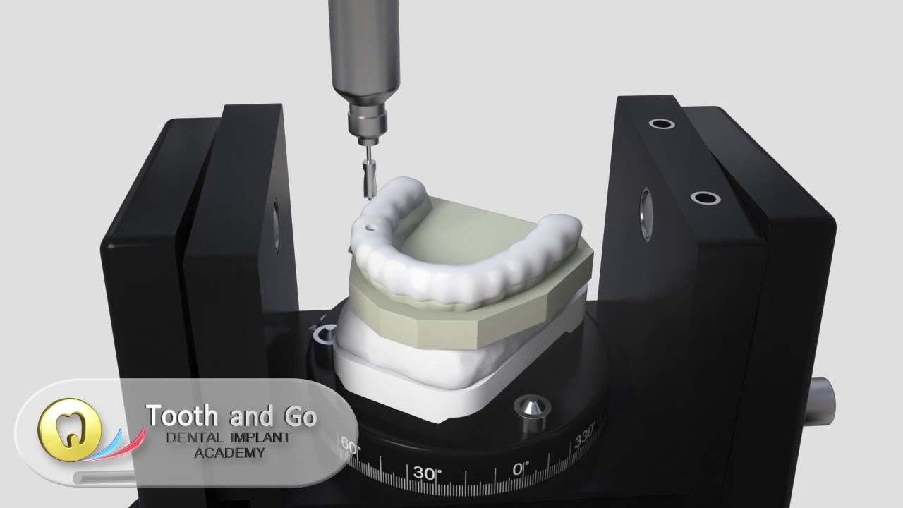 Straumann Guided Surgery - YouTube