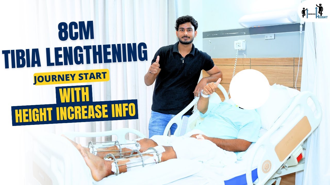 8cm Tibia Lengthening Journey Start with Height Increase Info - YouTube