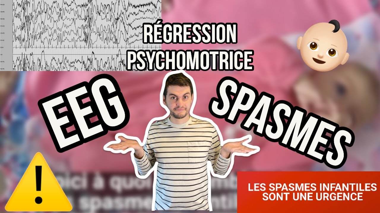 Spasmes infantiles - YouTube