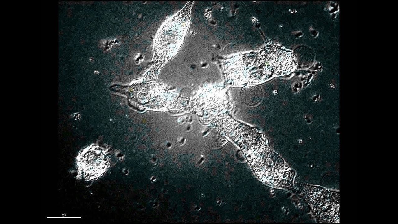 Oncosis in Cardiomyocytes - YouTube
