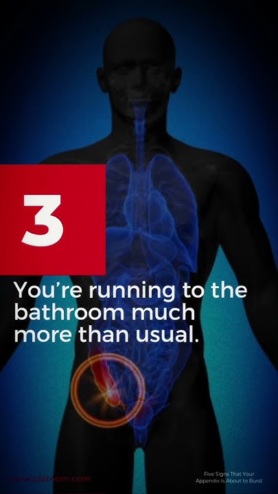 Five Signs That Your Appendix Is About to Burst - YouTube