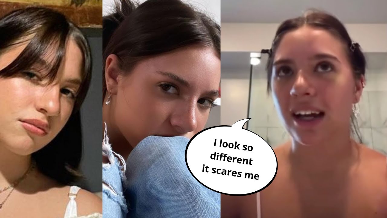 Kenzie Ziegler Confirms Nose Job! #kenzieziegler - YouTube