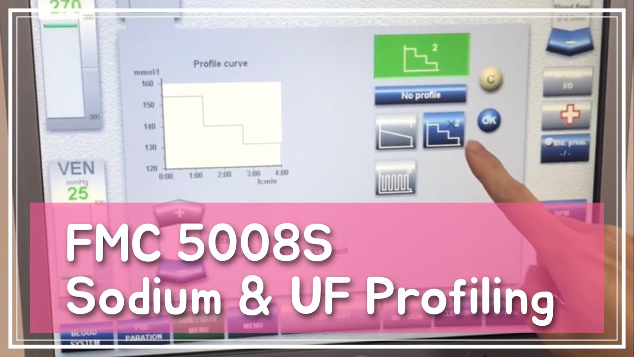 [AK STUDY] FMC 5008S Na & UF Profiling / Na & UF Scailing, 인공신장실 투석기 ...