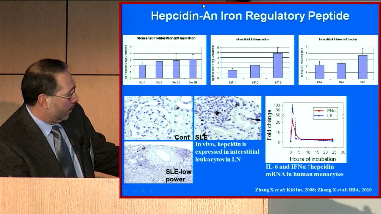 Brad Rovin presents "Omics Provides New Insights into Pathogenesis ...
