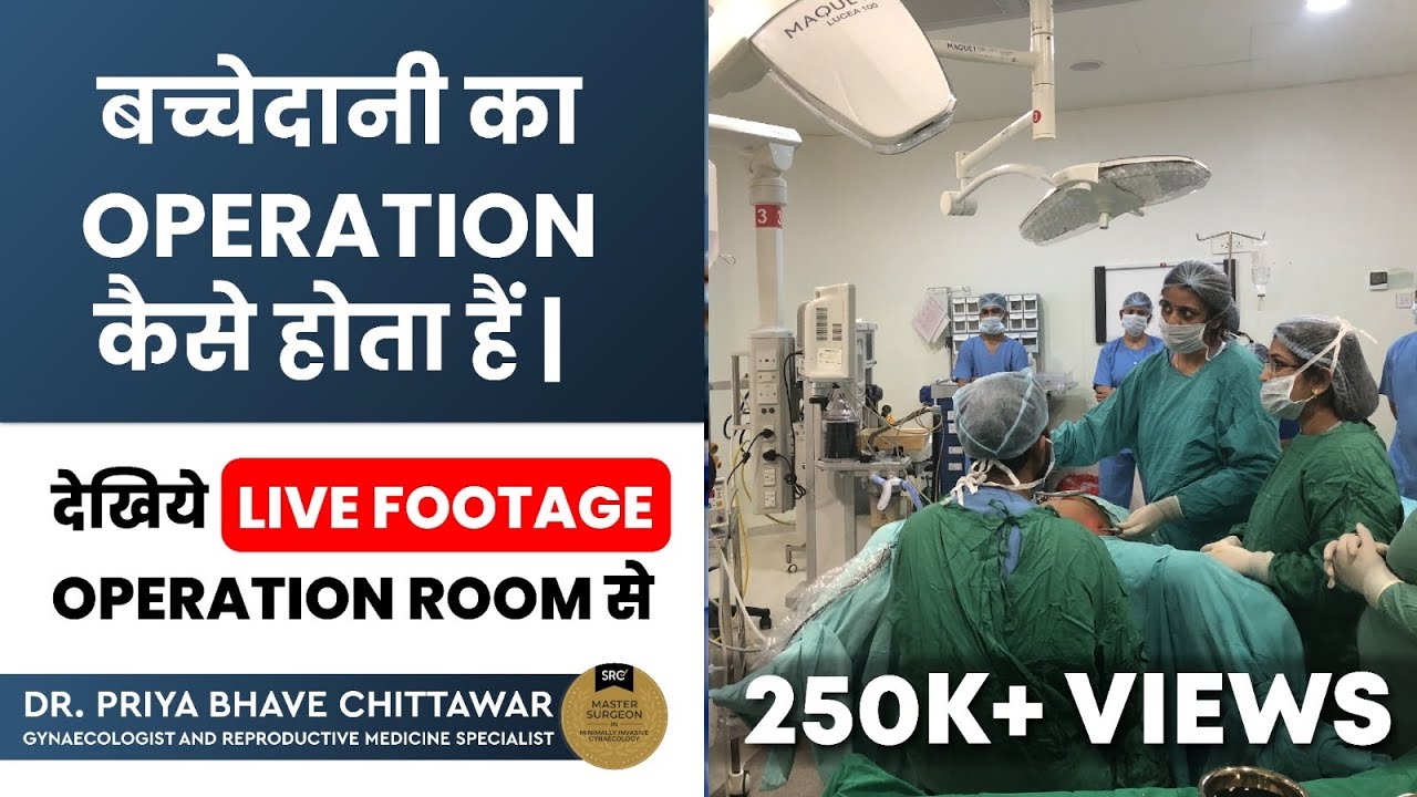 बच्चेदानी का operation कैसे होता है ? देखिए Live Footage ऑपरेशन रूम से ...