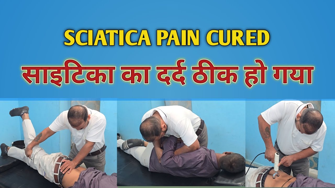 The best treatment for sciatica is this way || chiropractic cupping ...