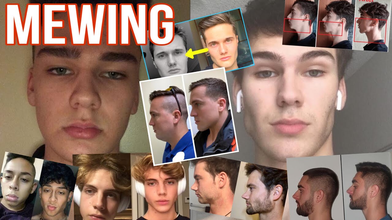 MEWING e HARD MEWING: La Guida Definitiva - YouTube