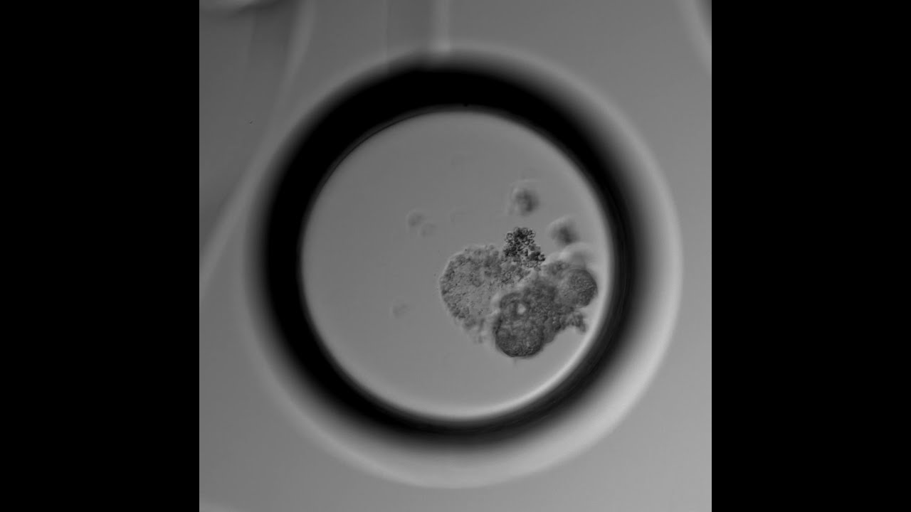 Granulosa Cells in the PeriVitelline Space - YouTube