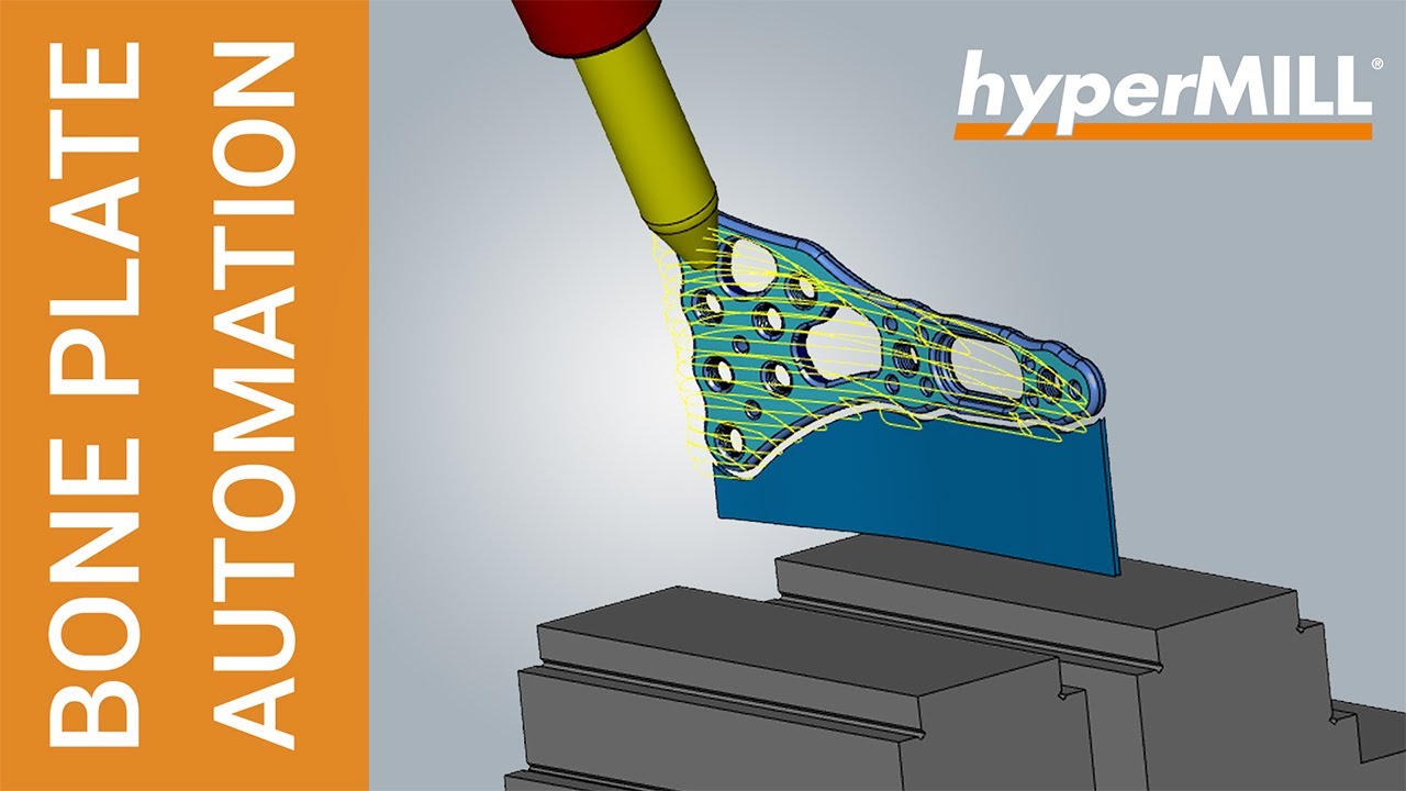 hyperMILL AUTOMATION CENTER: Bone Plate CAD/CAM Automation Use Case ...