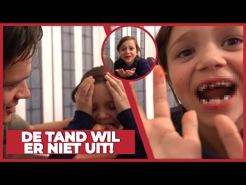 MADELIEF HAAR TAND WIL ER NIET UIT!! - #1315