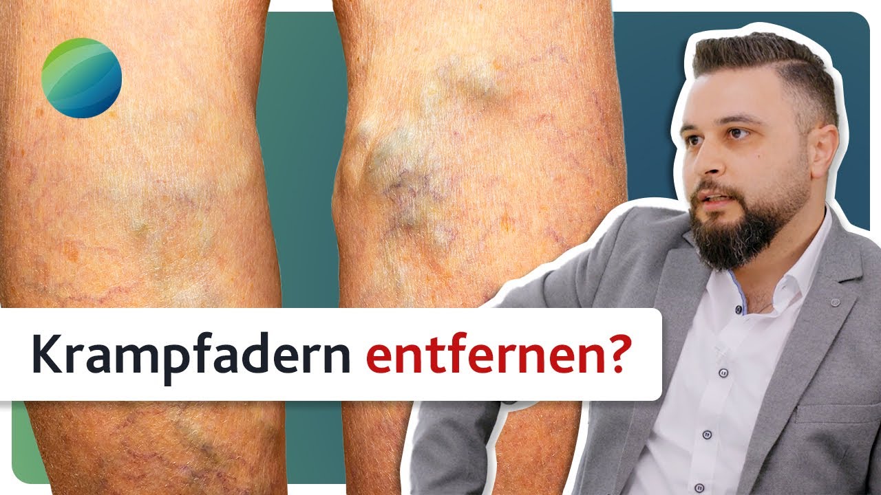 Wann Autofahren Nach Krampfader Op