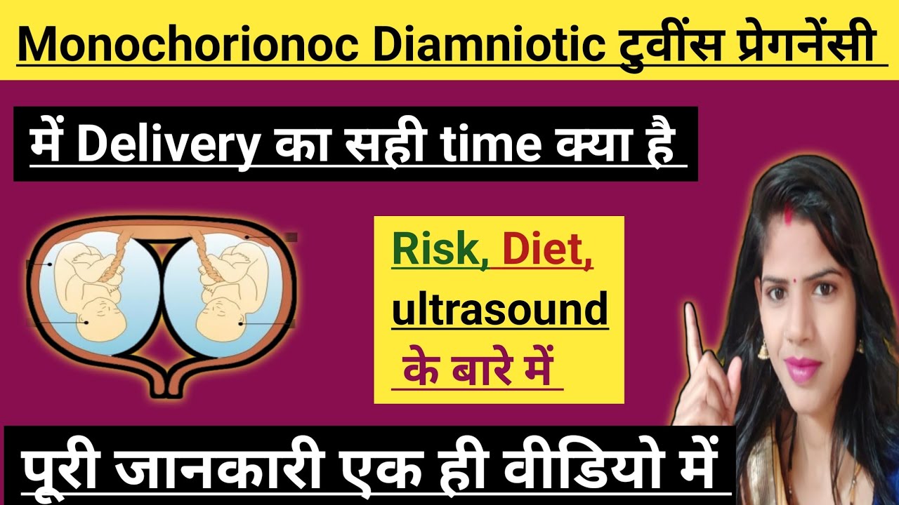 Monochorionic Diamniotic twins pregnancy kya h monochorionic Diamniotic ...