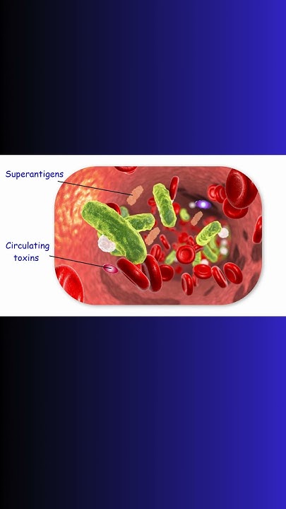 FLESH EATING BACTERIA and INFLAMMATION! #bacteria #immune #antigen # ...