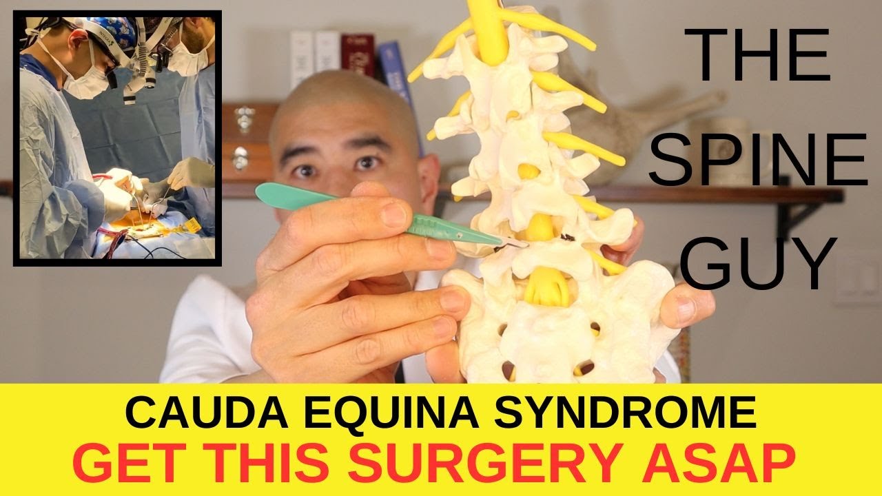 Surgical Treatment for Cauda Equina Syndrome - YouTube