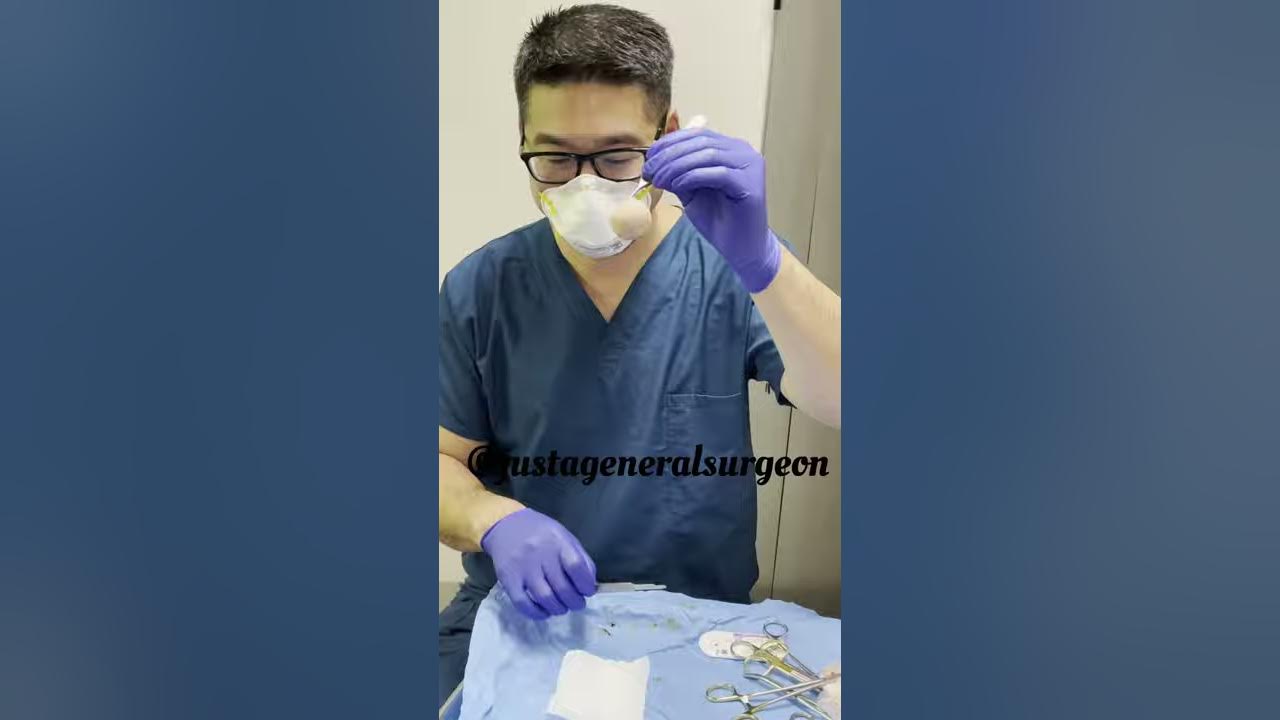 Inside The Or With Justageneralsurgeon Cutting Open My Prize A Juicy Sebaceous Cyst Pimple