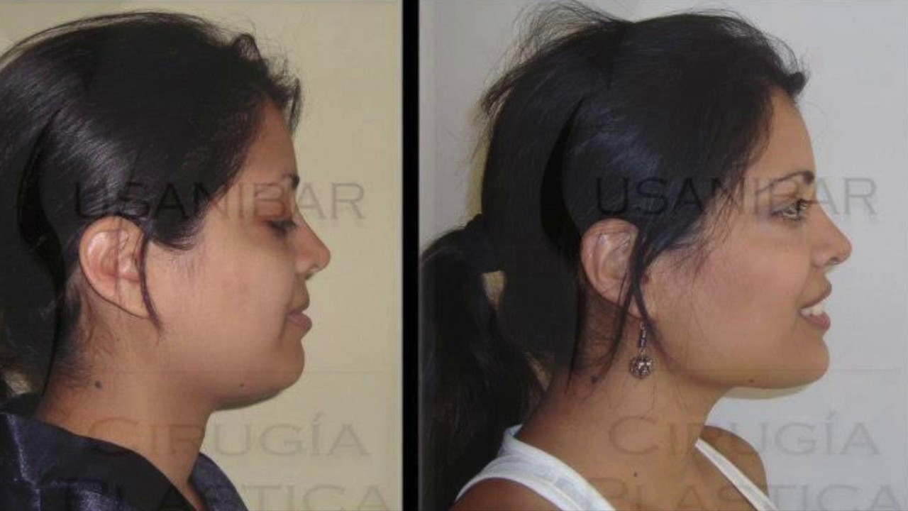 PERFILAMIENTO DE ROSTRO - YouTube