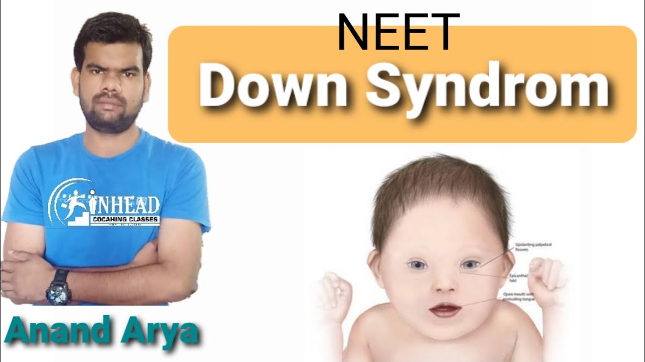 Down Syndrome | NEET | CLASS 12 | INHEAD | UPSC | ANAND ARYA - YouTube